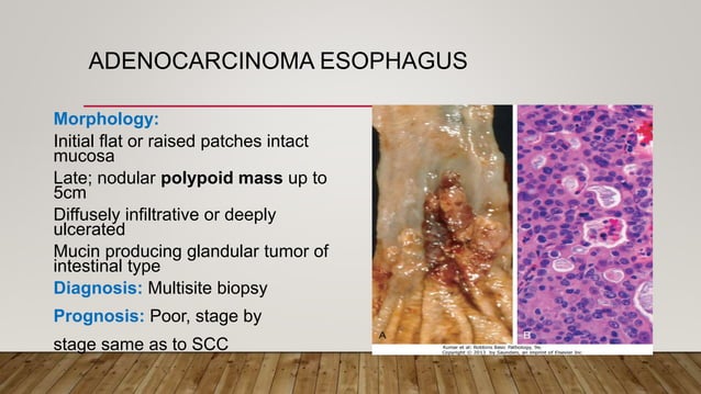 salivary gland and esophagus | PPT