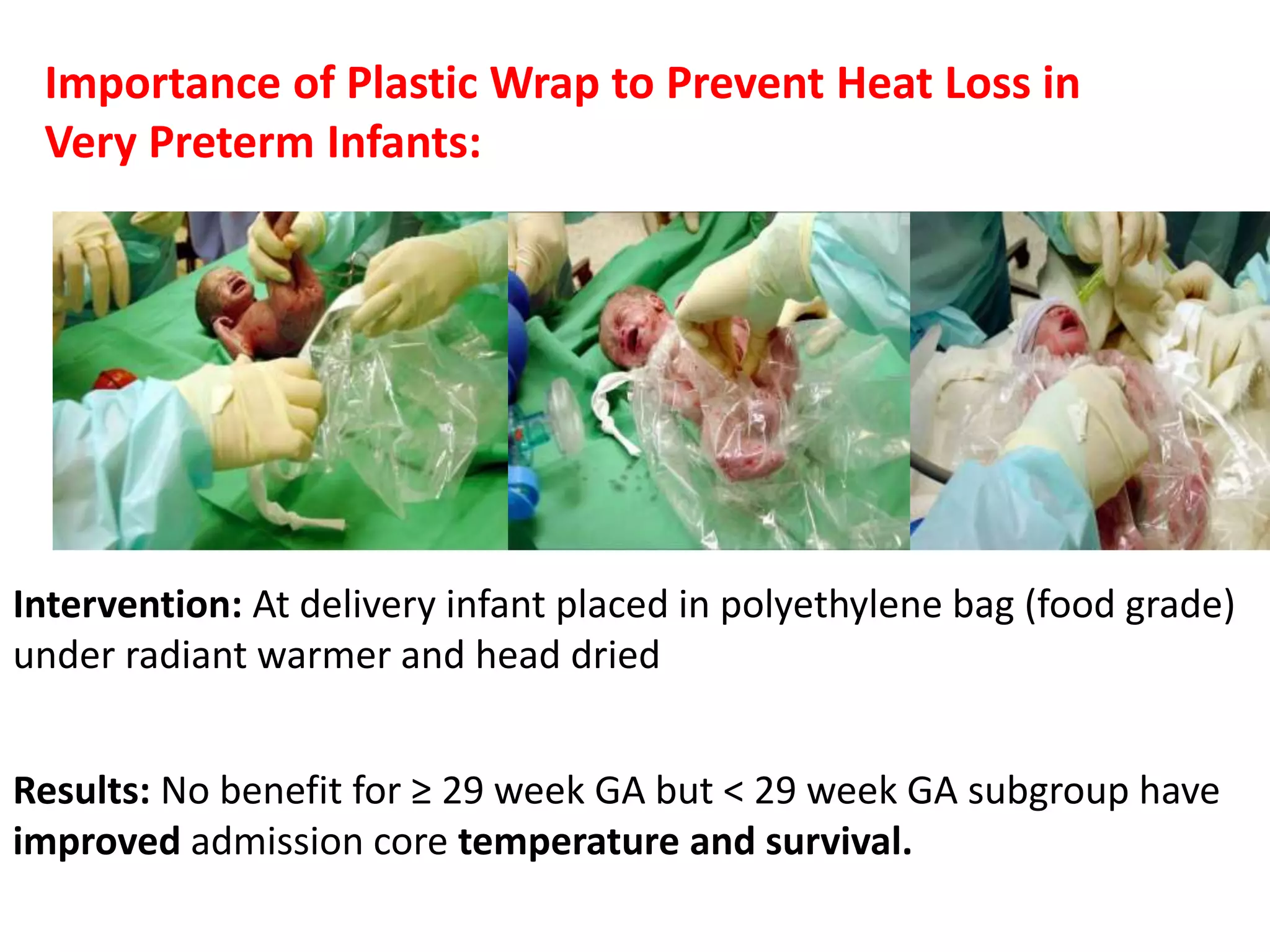 Nursing care of ELBW and LBW babies | PPTX
