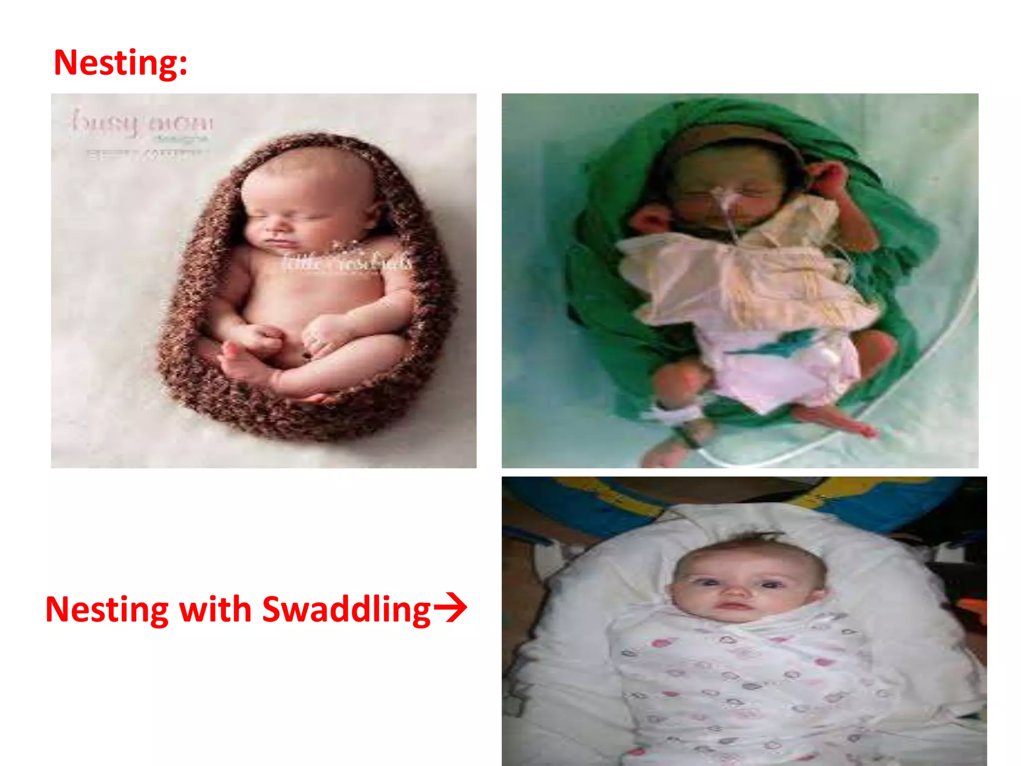 Nursing care of ELBW and LBW babies | PPTX