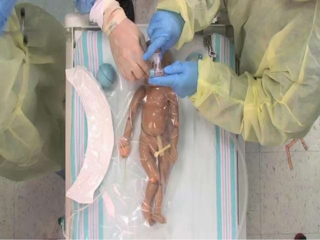 Nursing care of ELBW and LBW babies