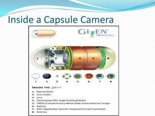 Lec 2 Medical Equipment Endoscopes | PPT