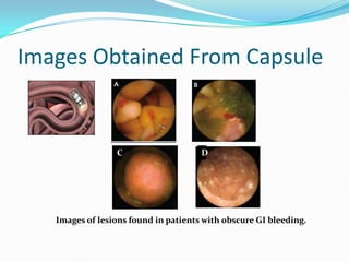 Lec 2 Medical Equipment Endoscopes | PPT