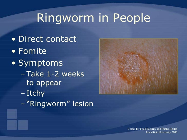 Lec 21 22 Zoonotic Diseases