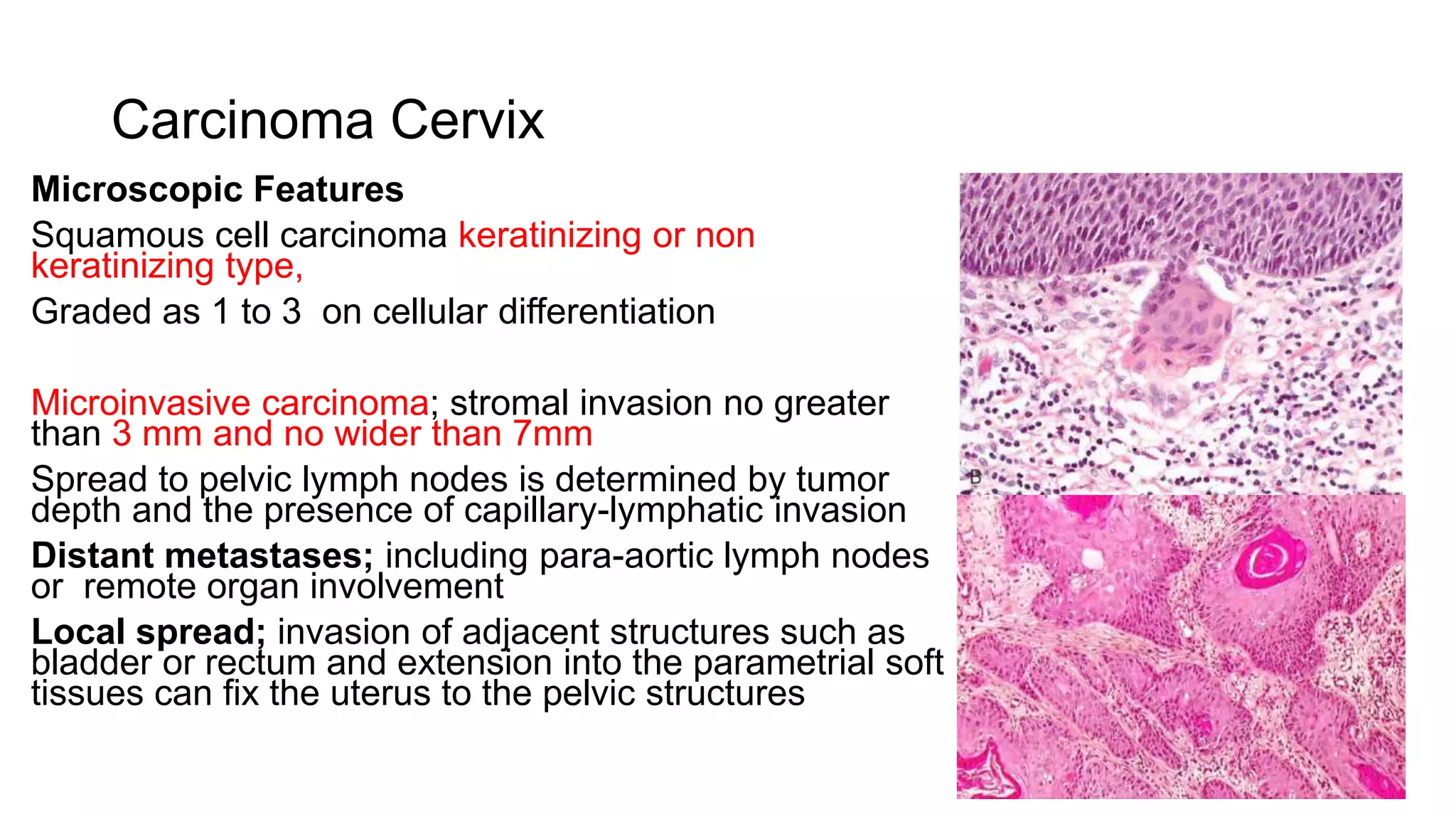 Lec 24 24 female reproductive system pathology | PPTX