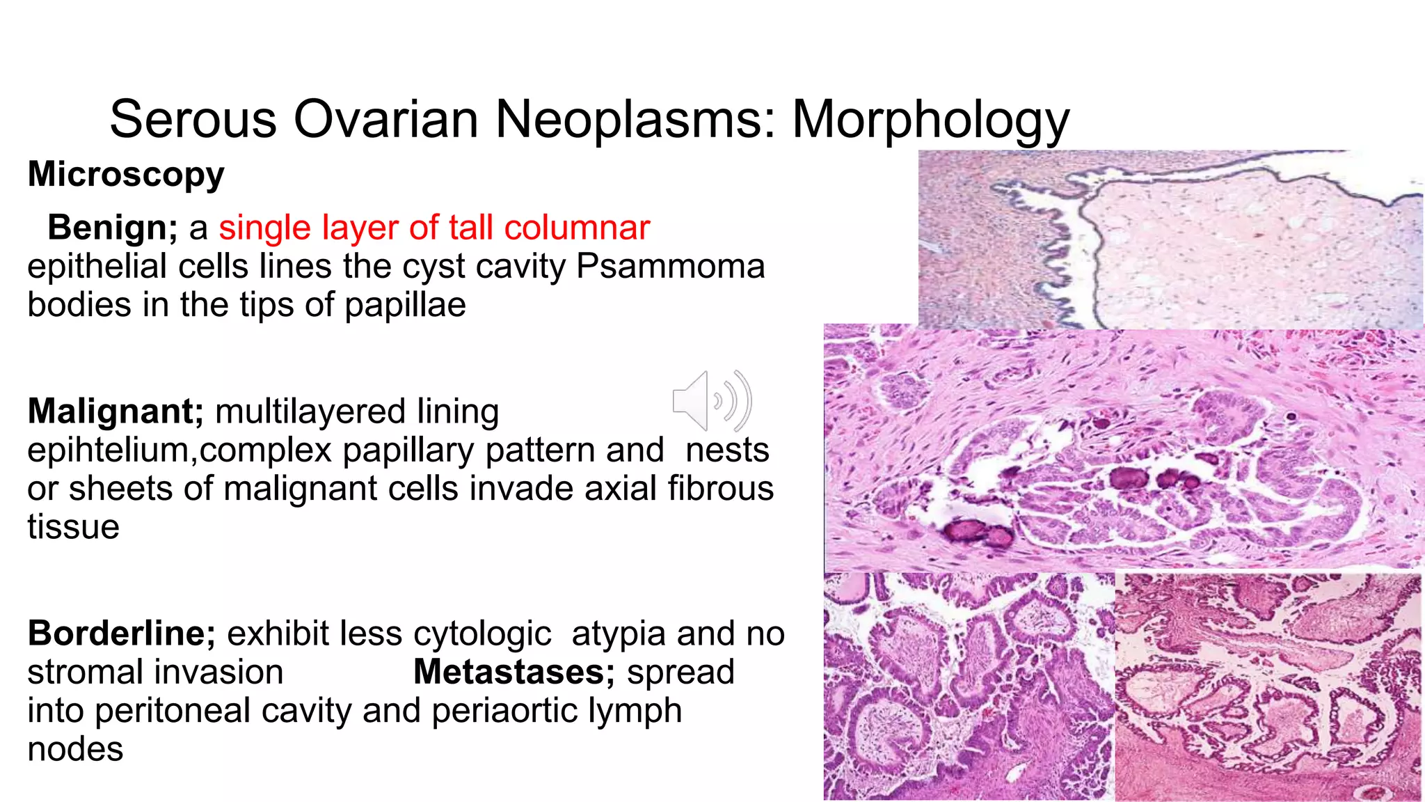 Lec 24 24 female reproductive system pathology | PPTX