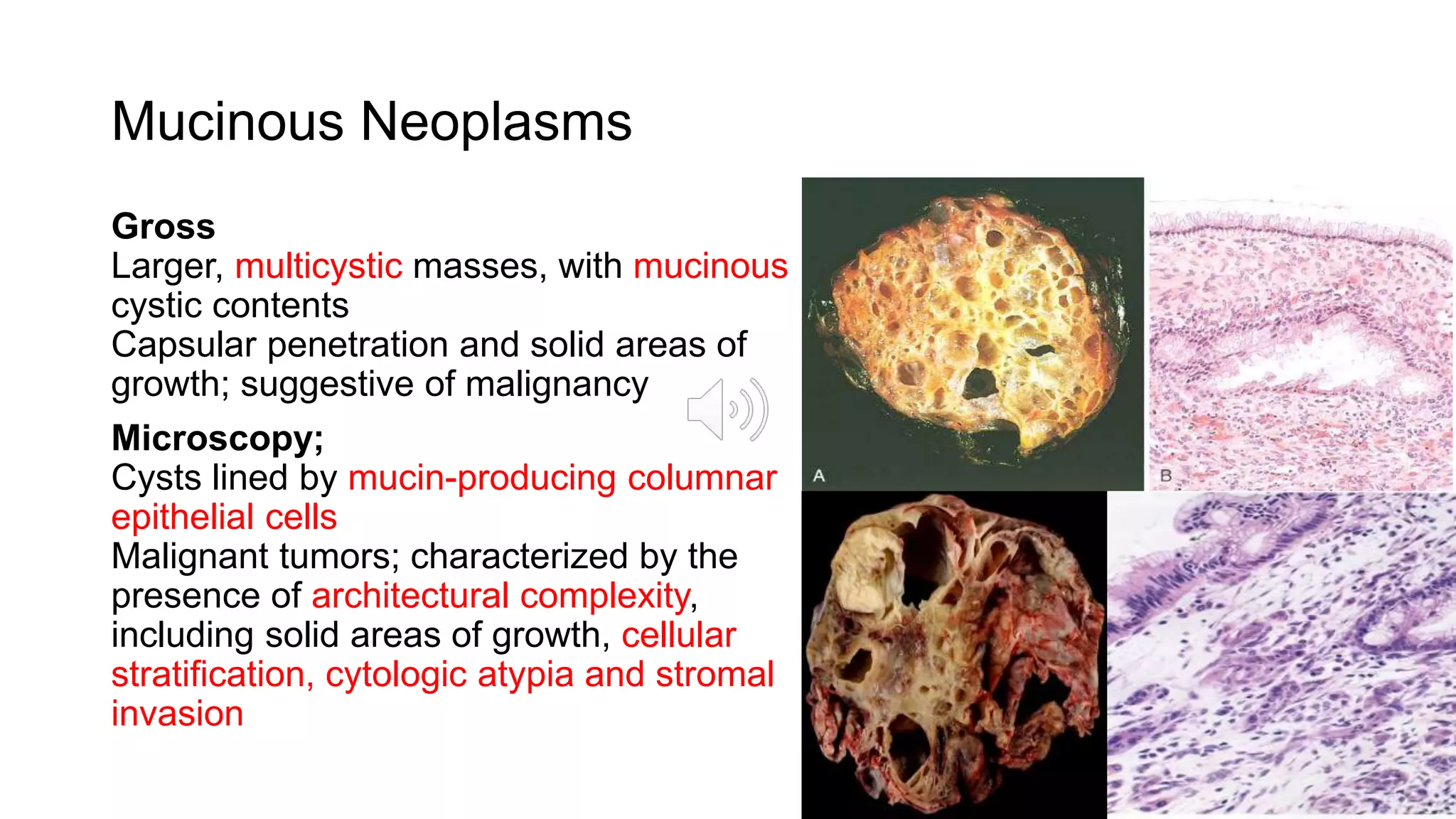 Lec 24 24 female reproductive system pathology | PPTX