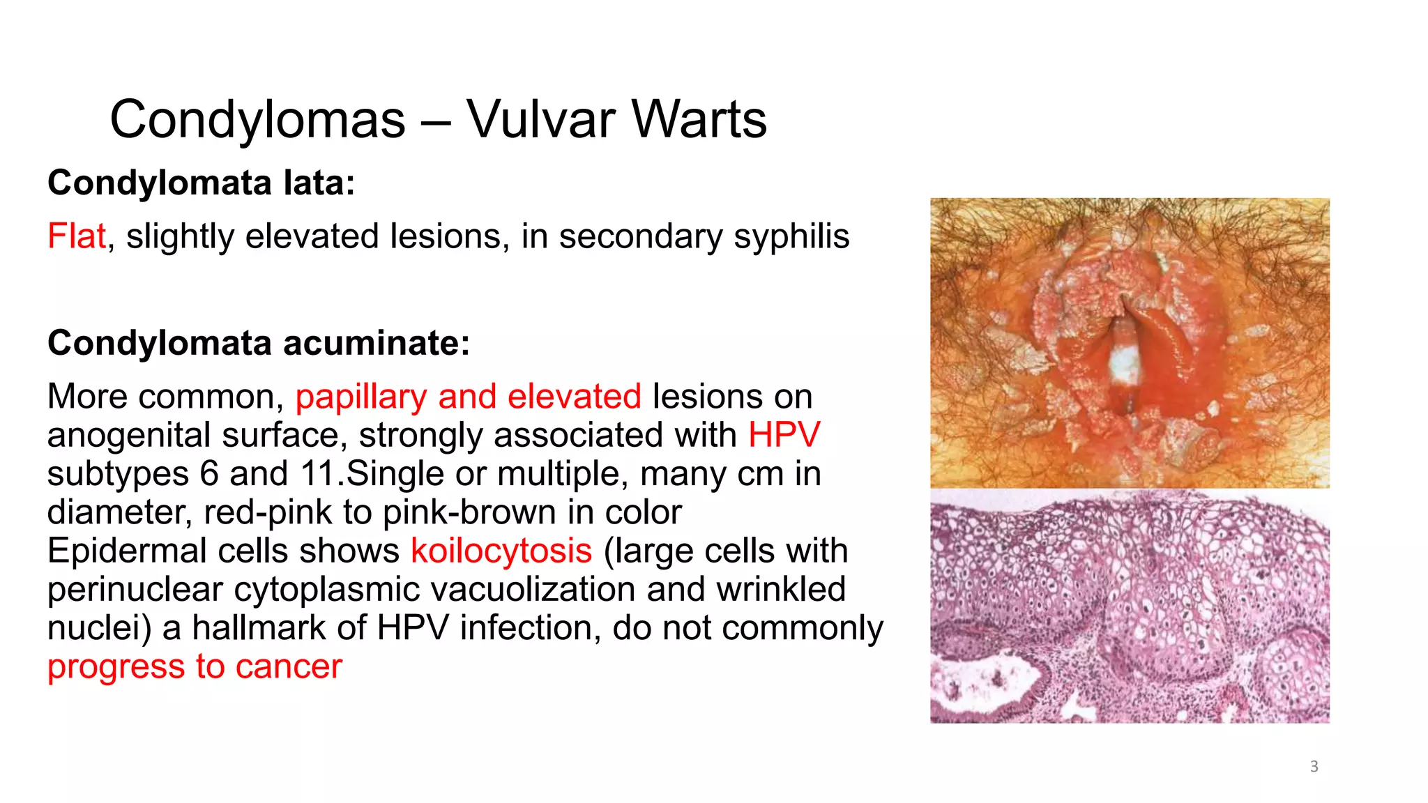 Lec 24 24 female reproductive system pathology | PPTX