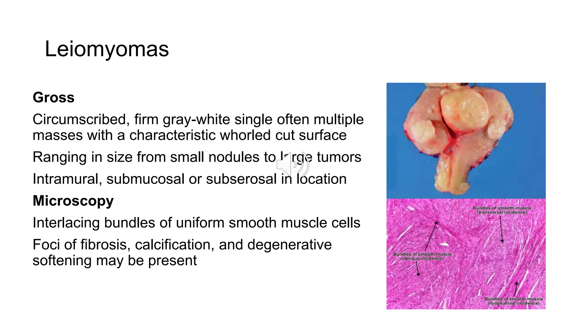 Lec 24 24 female reproductive system pathology | PPTX