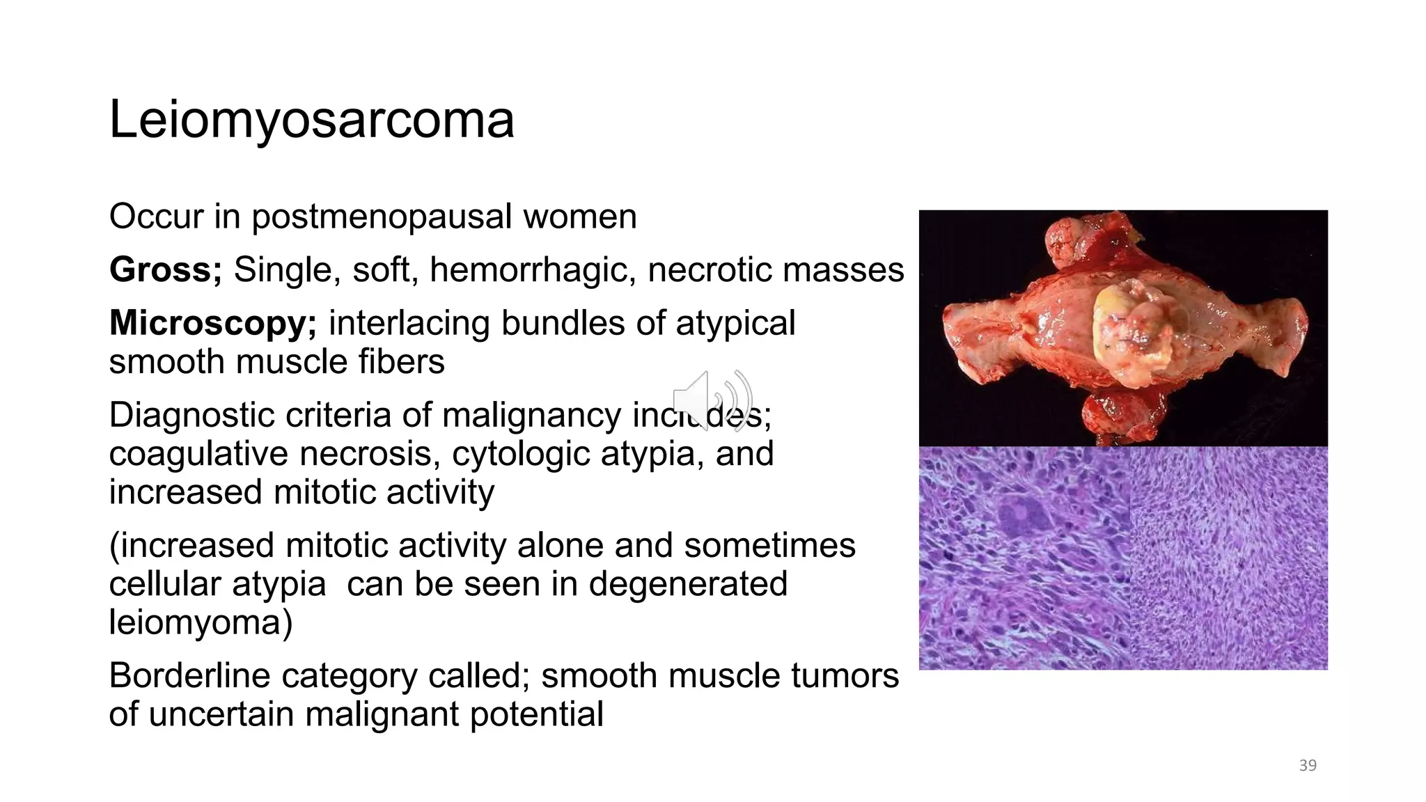 Lec 24 24 female reproductive system pathology | PPTX
