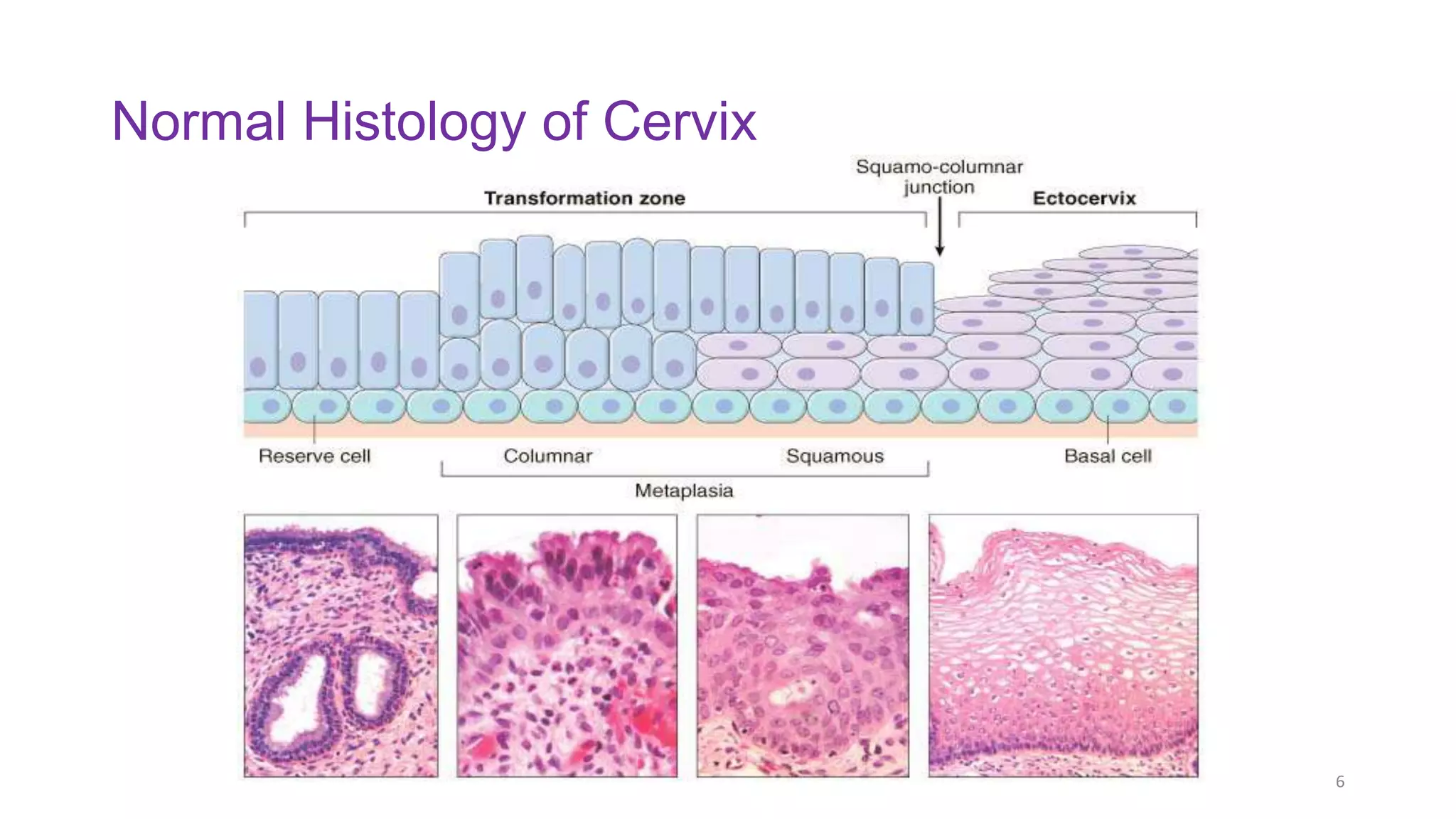 Lec 24 24 female reproductive system pathology | PPTX