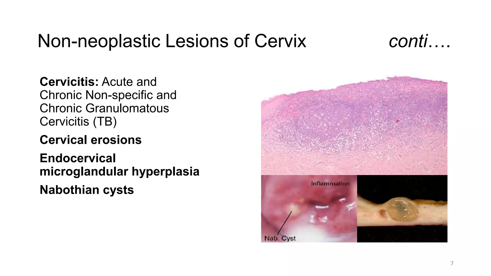 Lec 24 24 female reproductive system pathology | PPTX