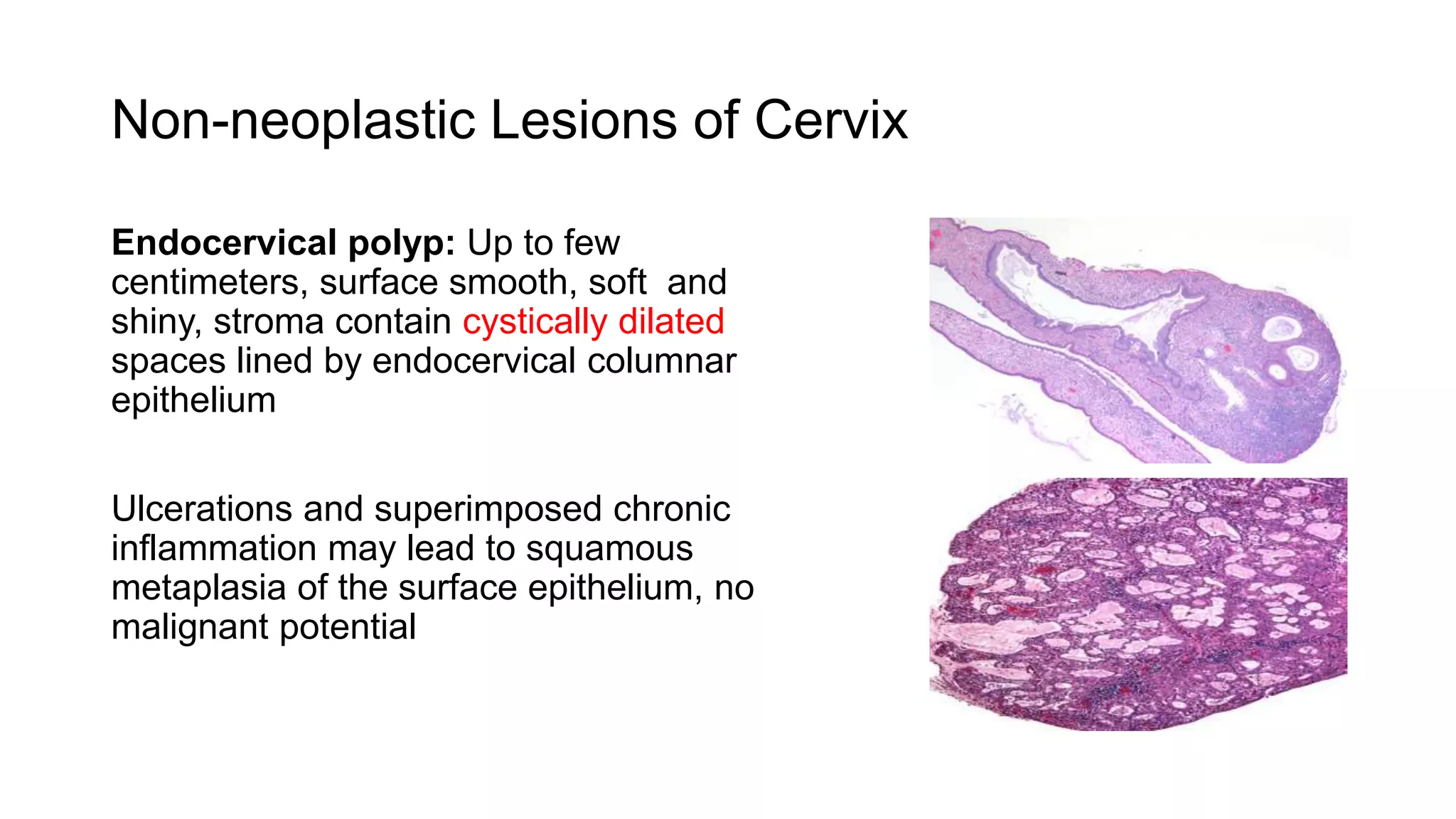Lec 24 24 female reproductive system pathology | PPTX