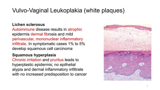 Lec 24 24 female reproductive system pathology | PPTX
