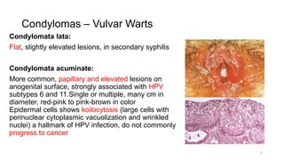 Lec 24 24 female reproductive system pathology | PPTX