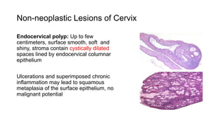Lec 24 24 female reproductive system pathology | PPTX