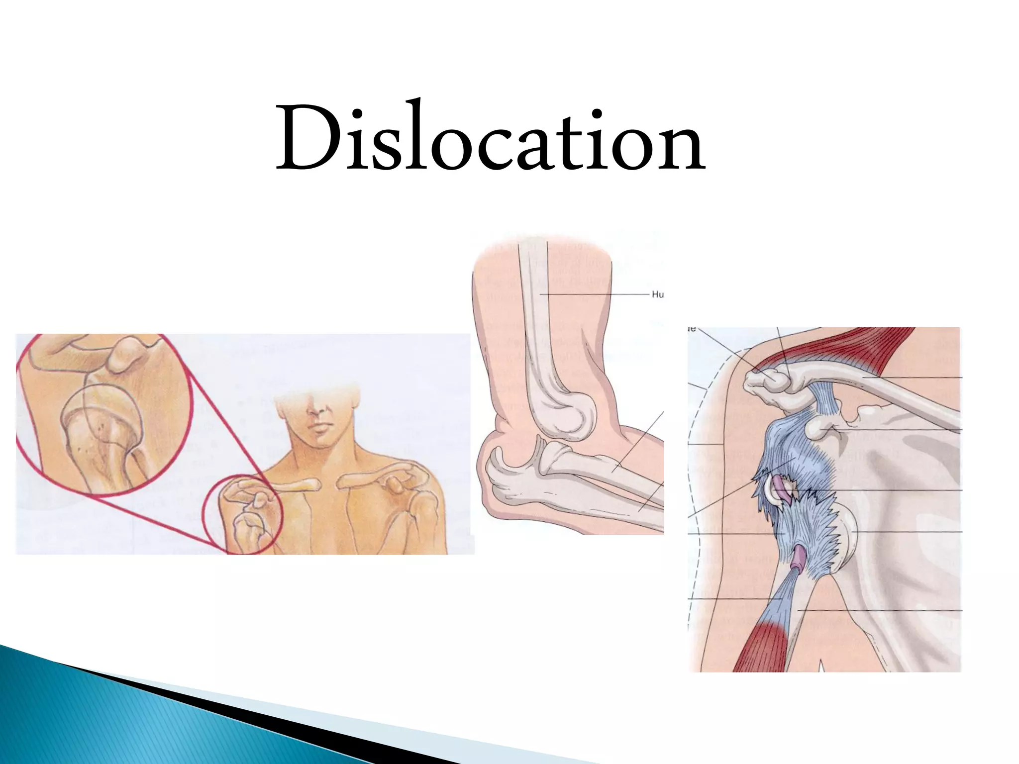 Lec 24 Orthopedic Emergency trauma fracture dislocation sprain strain.pdf