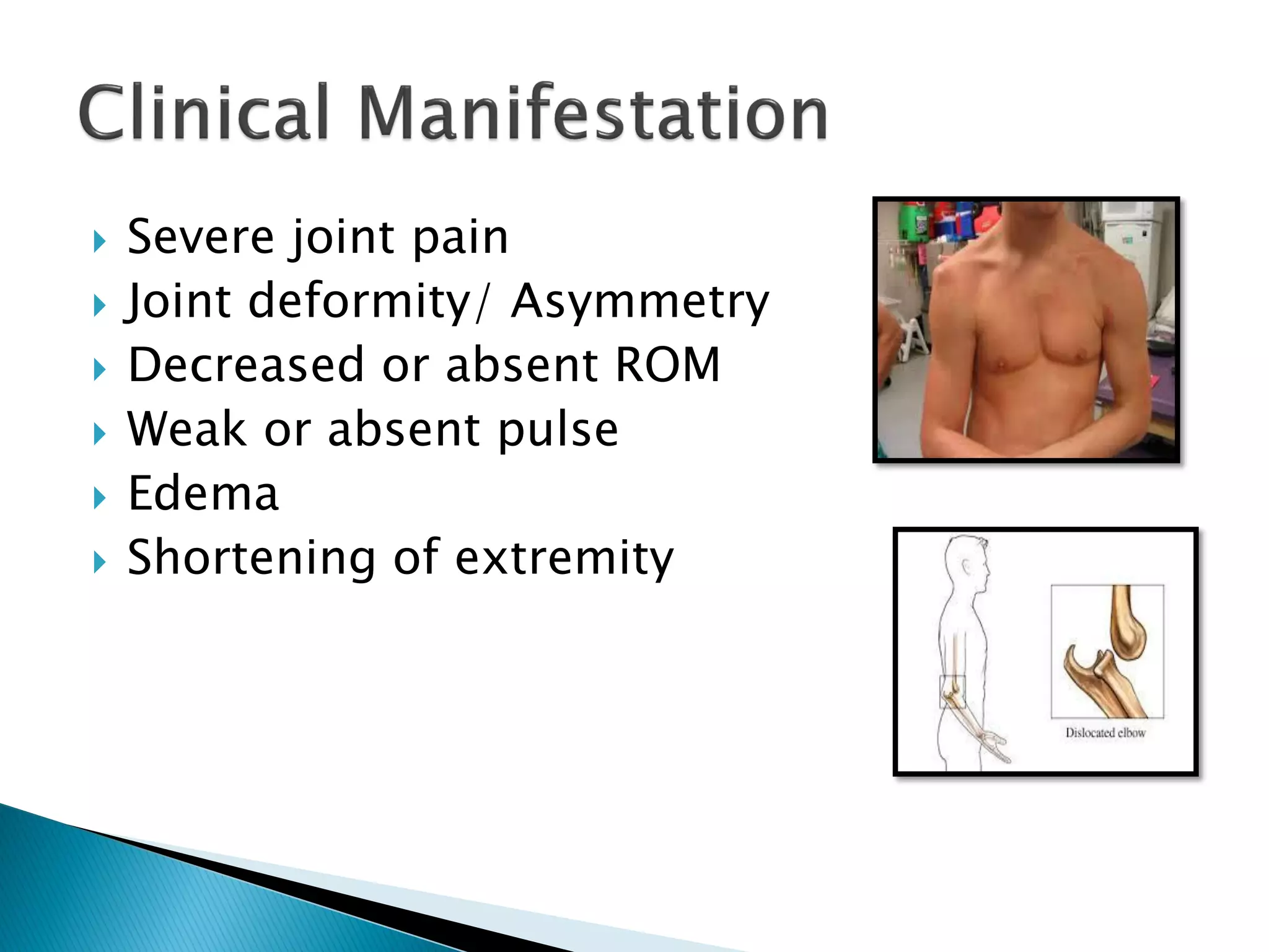 Lec 24 Orthopedic Emergency trauma fracture dislocation sprain strain.pdf