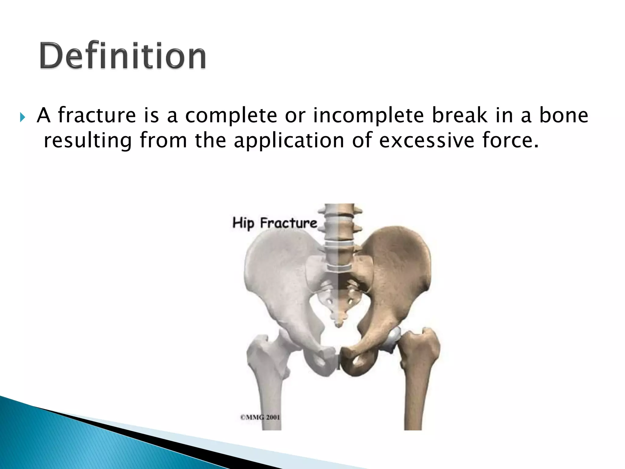 Lec 24 Orthopedic Emergency trauma fracture dislocation sprain strain.pdf