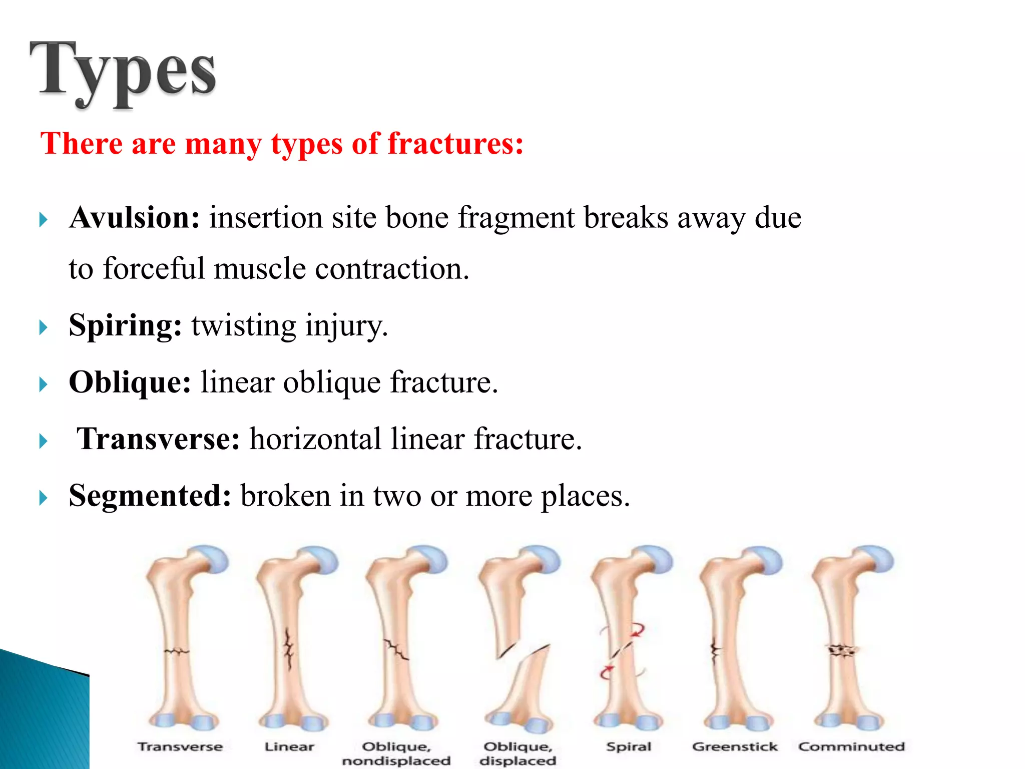 Lec 24 Orthopedic Emergency trauma fracture dislocation sprain strain.pdf