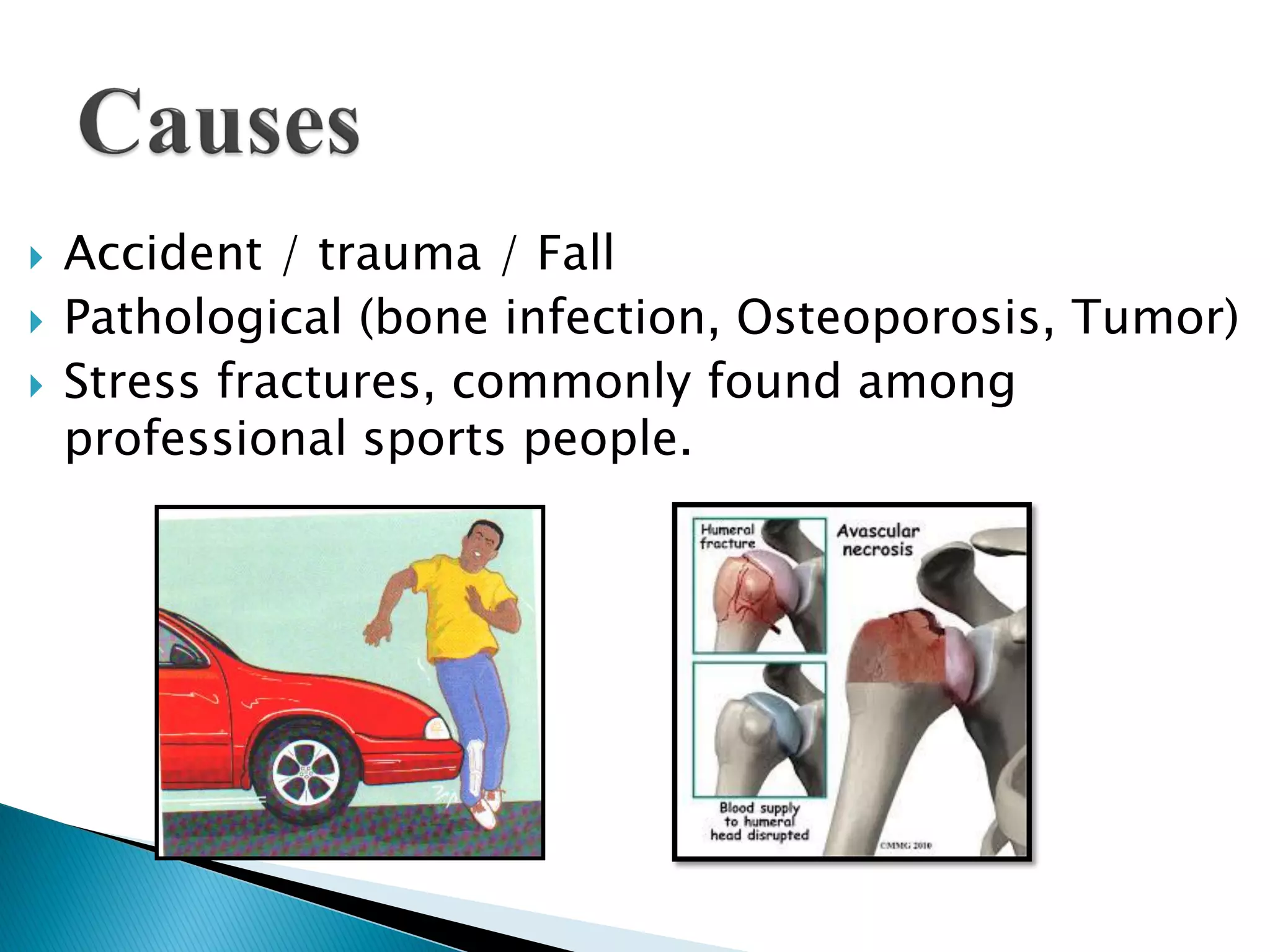 Lec 24 Orthopedic Emergency trauma fracture dislocation sprain strain.pdf