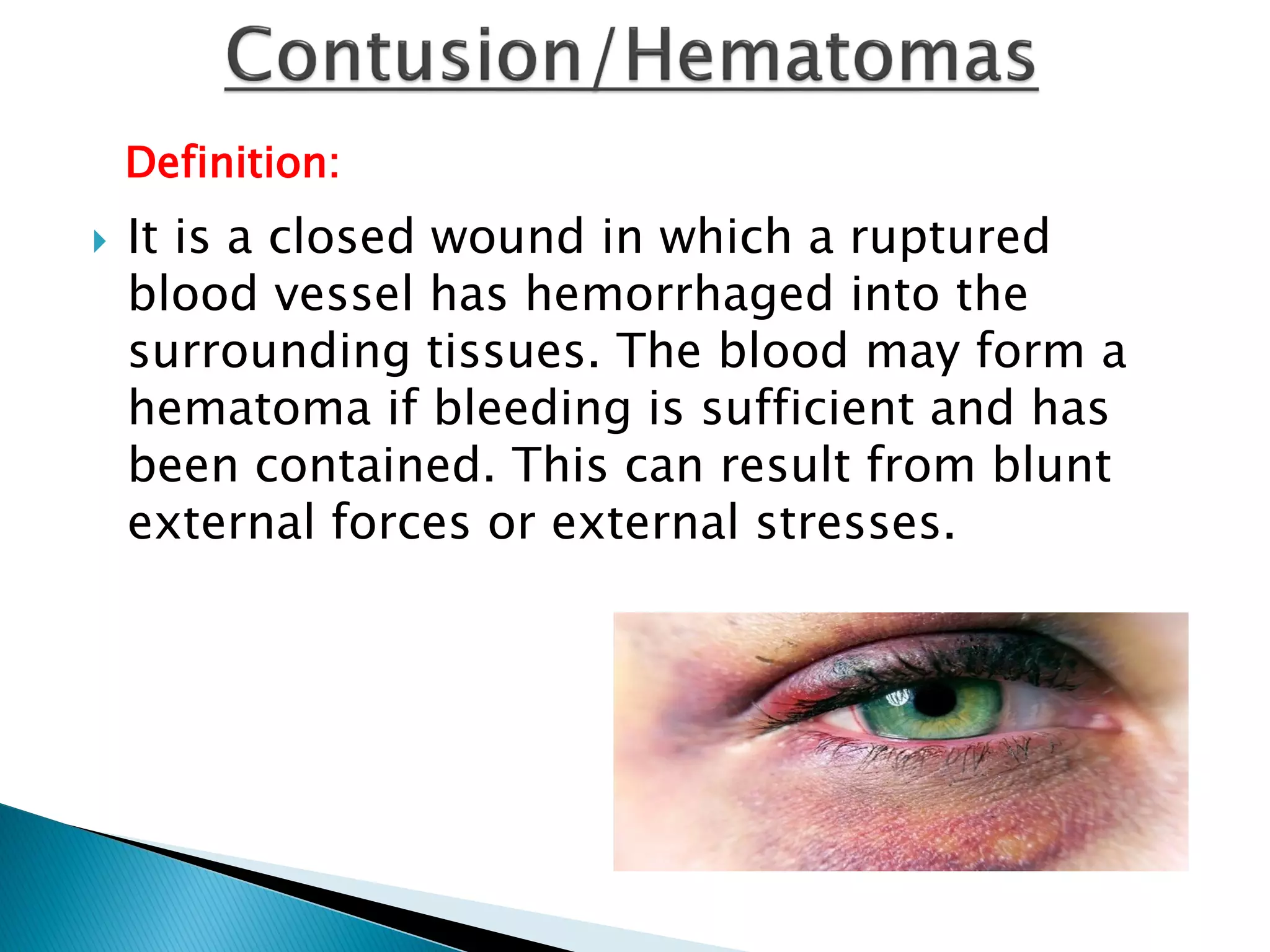 Lec 24 Orthopedic Emergency trauma fracture dislocation sprain strain.pdf