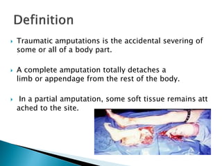 Lec 24 Orthopedic Emergency trauma fracture dislocation sprain strain.pdf
