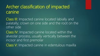 Lec 2 principles of management of impacted teeth | PPT