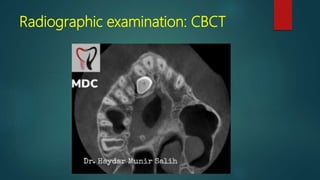 Lec 2 principles of management of impacted teeth | PPT