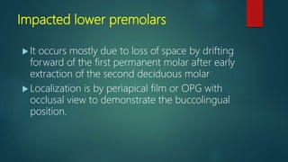 Lec 2 principles of management of impacted teeth | PPT