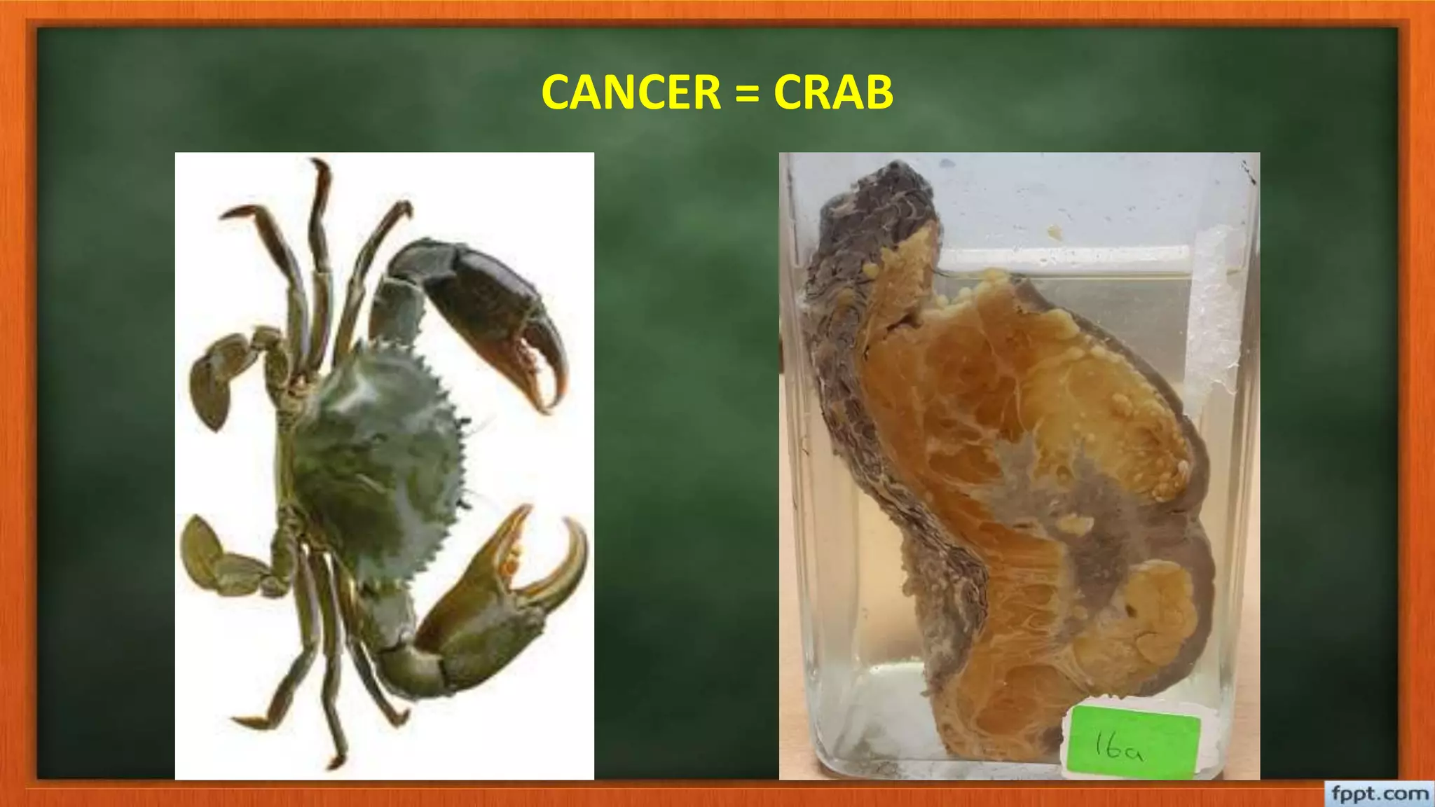 LEC 2: ODONTOGENIC TUMORS AND TUMOR LIKE LESIONS OF THE JAW | PPTX ...