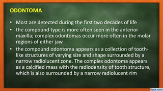 LEC 2: ODONTOGENIC TUMORS AND TUMOR LIKE LESIONS OF THE JAW | PPTX ...