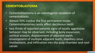 LEC 2: ODONTOGENIC TUMORS AND TUMOR LIKE LESIONS OF THE JAW | PPTX
