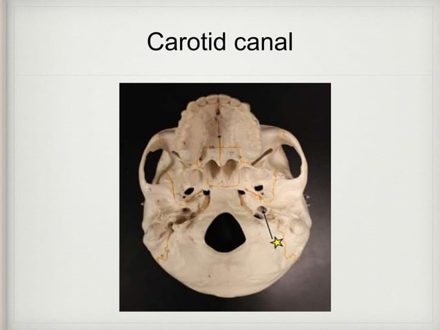 Lecture 2 skull chapter (2) | PPT