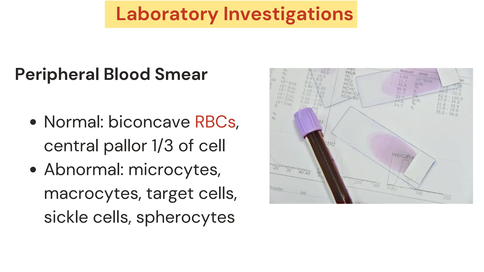 Platelet Disorders : hematology theory lecture | PDF