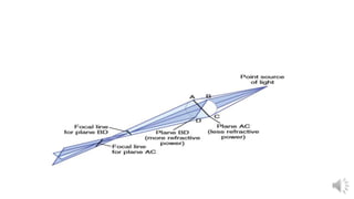 Lec#3 ERRORS OF REFRACTION 2 15-4-21.pptx