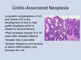 IBD and appendicitis | PPT | Digestive Disorders | Diseases and Conditions