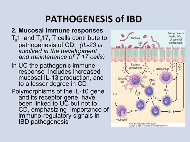 IBD and appendicitis | PPT