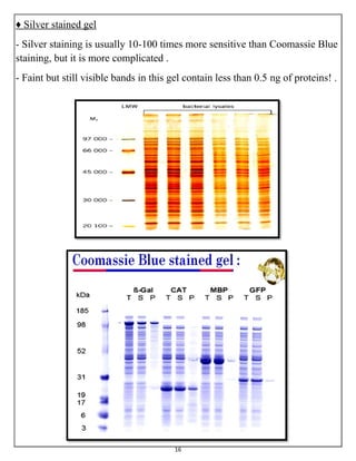 Biosynthetic reactions of amino acids and Gel Electrophoresis | PDF