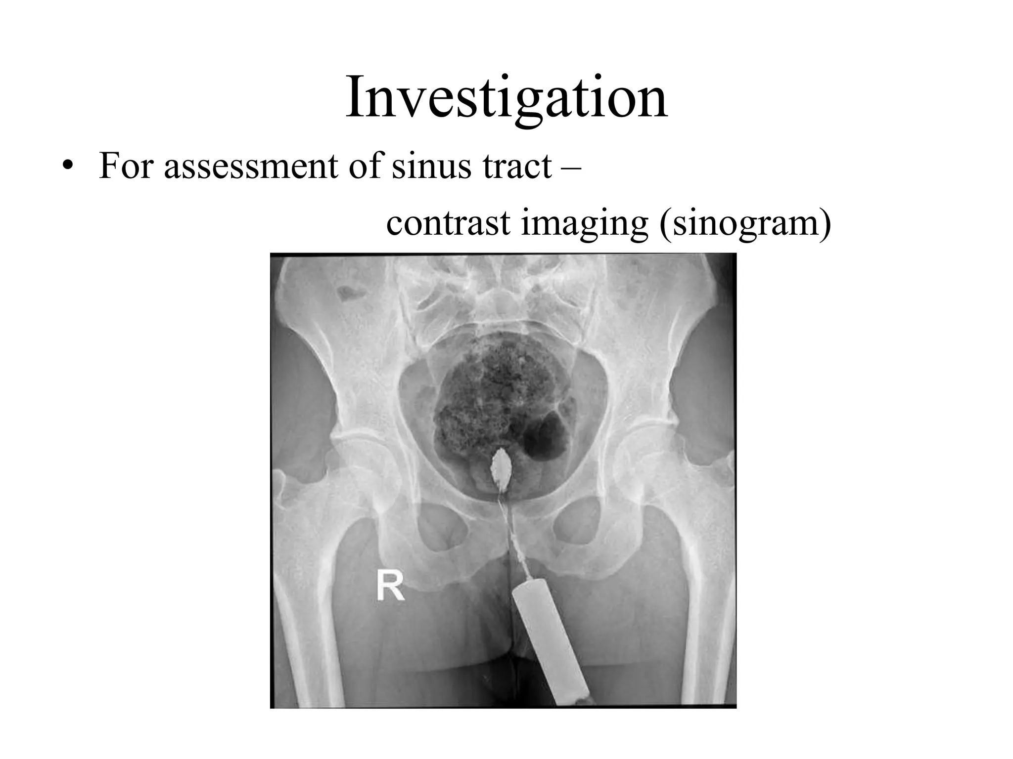 lec 3 rd year sinus.pptx