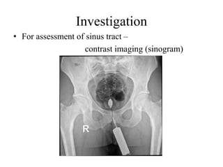 lec 3 rd year sinus.pptx