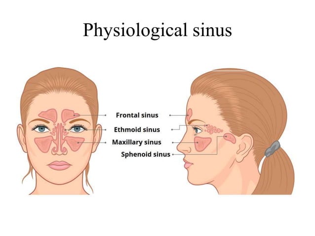 lec 3 rd year sinus.pptx