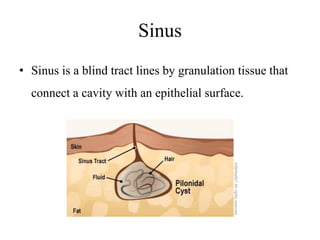 lec 3 rd year sinus.pptx