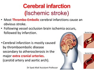 Stroke & its Management ( Medicine) | PPTX