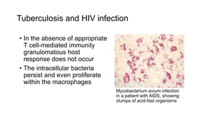 Lec 3 tuberculosis 3 | PPTX