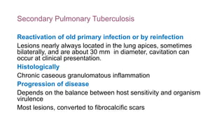 Lec 3 tuberculosis 3 | PPTX