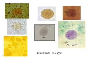 Entamoeba gingivalis and giardia lamblia | PPTX