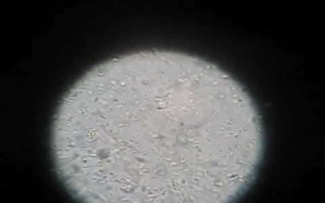 Entamoeba gingivalis and giardia lamblia | PPTX