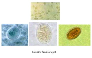 Giardia Ova