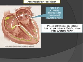 Antiarrhythmic_drugs | PPT