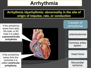 Antiarrhythmic_drugs | PPT